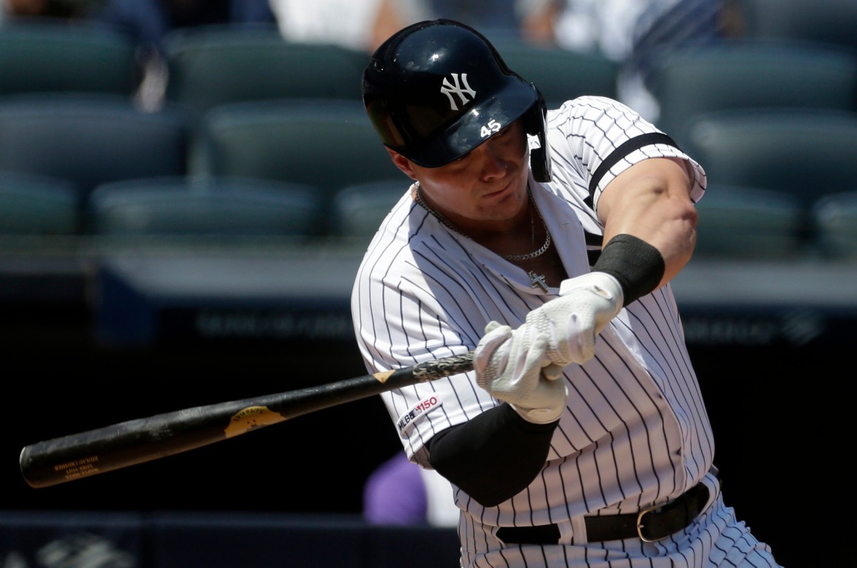 Luke Voit shows off new look after taking fastball to the face