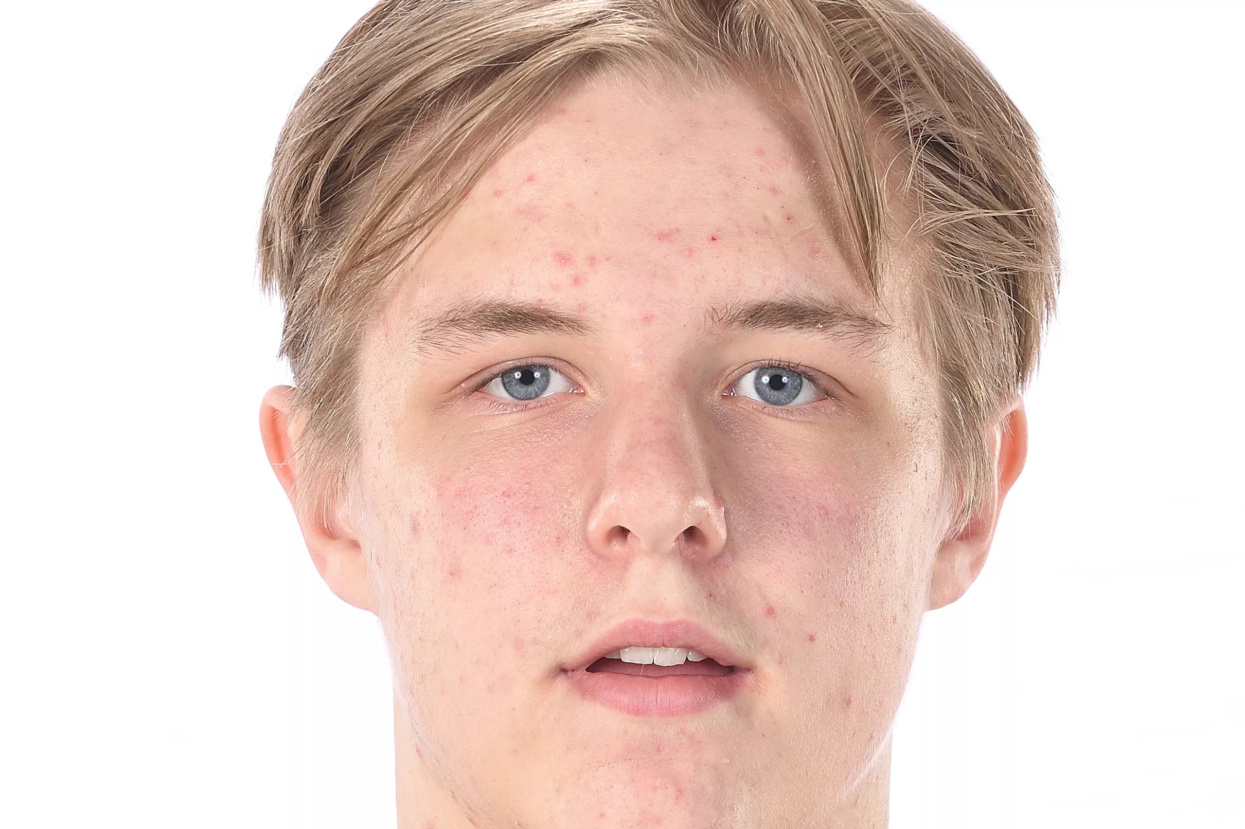 2018 NHL Draft prospect profile: Jonatan Berggren is defined by his ...