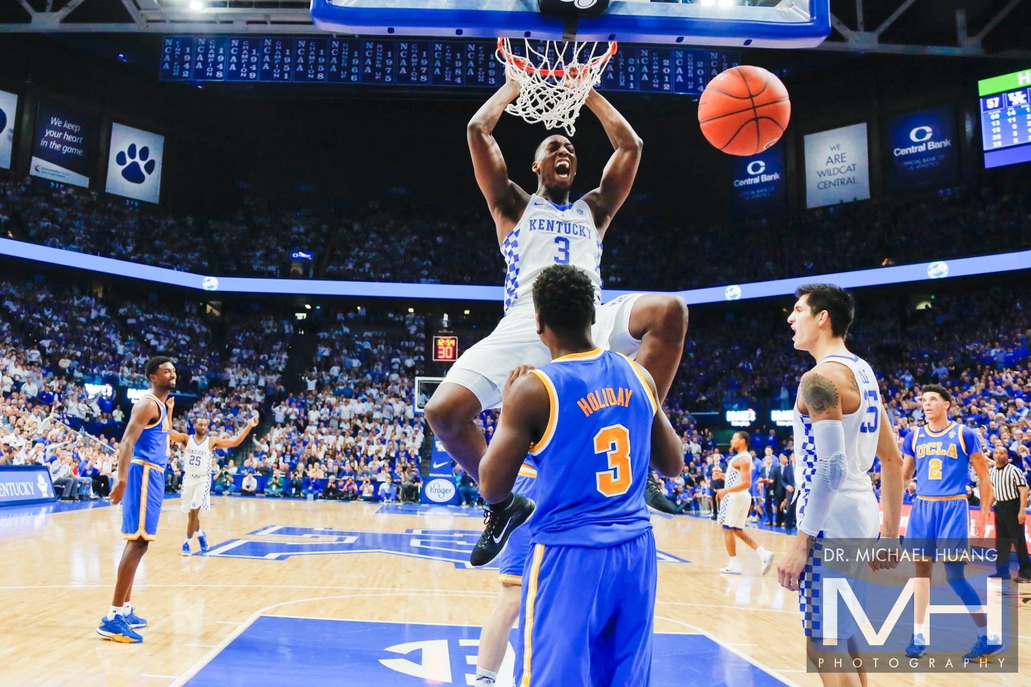 Why UK will beat UCLA on Friday