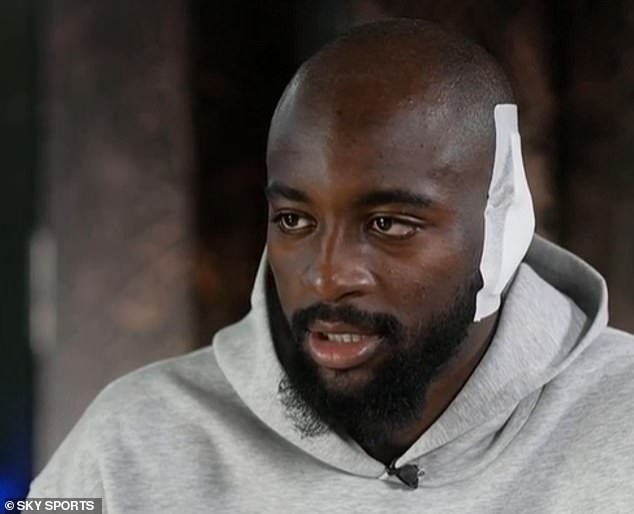 Jean-Philippe Mateta sports HUGE bandage on his head in first TV ...